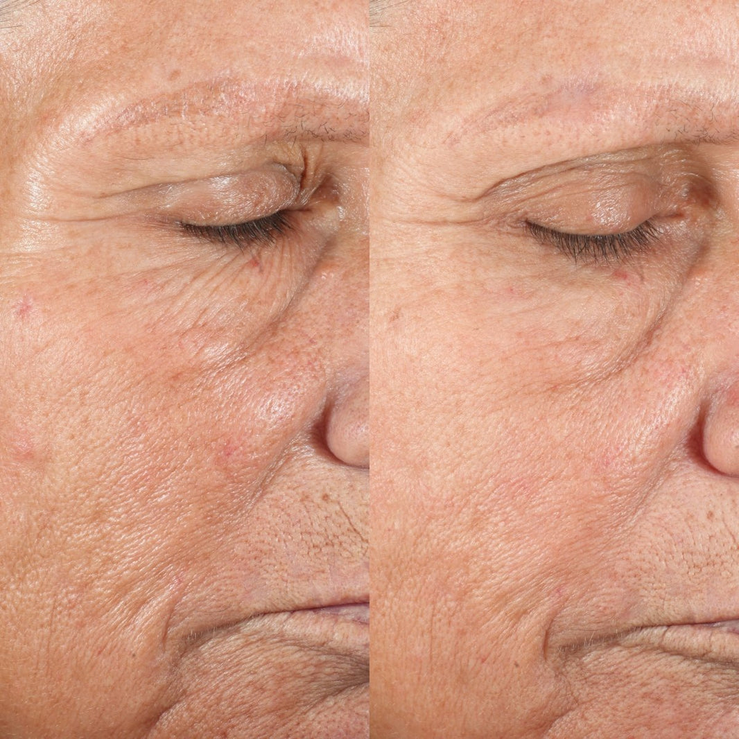 Learn More PMD Clean – PMD Beauty