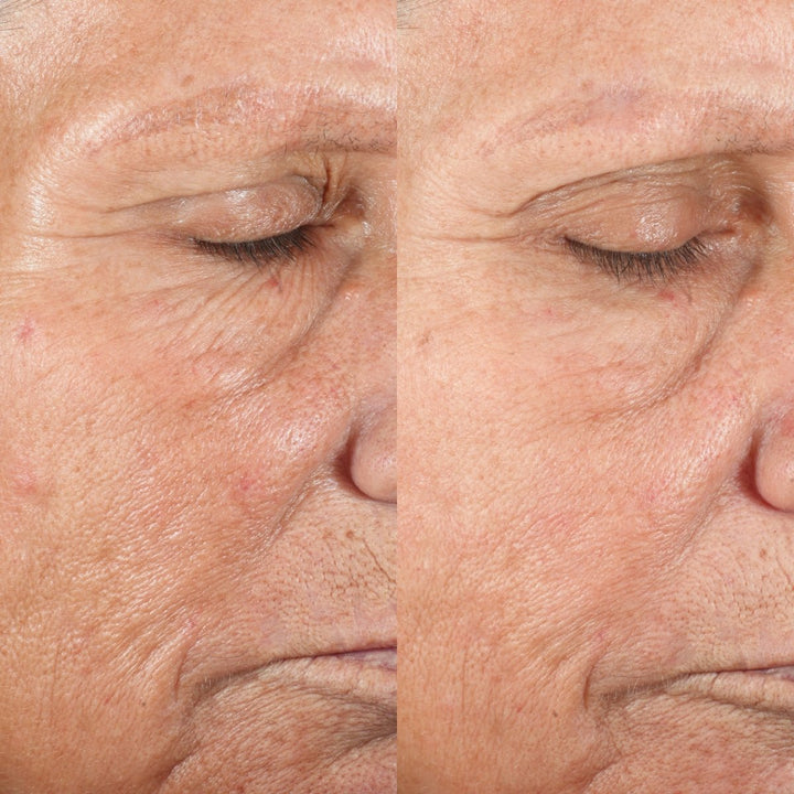 PMD Clean – PMD Beauty