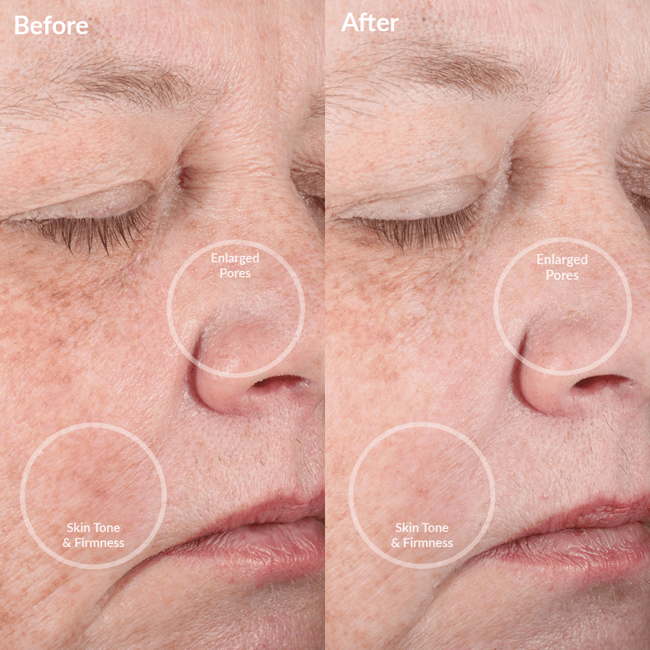 Facial Cleansing Device - PMD Clean Pro | PMD Beauty