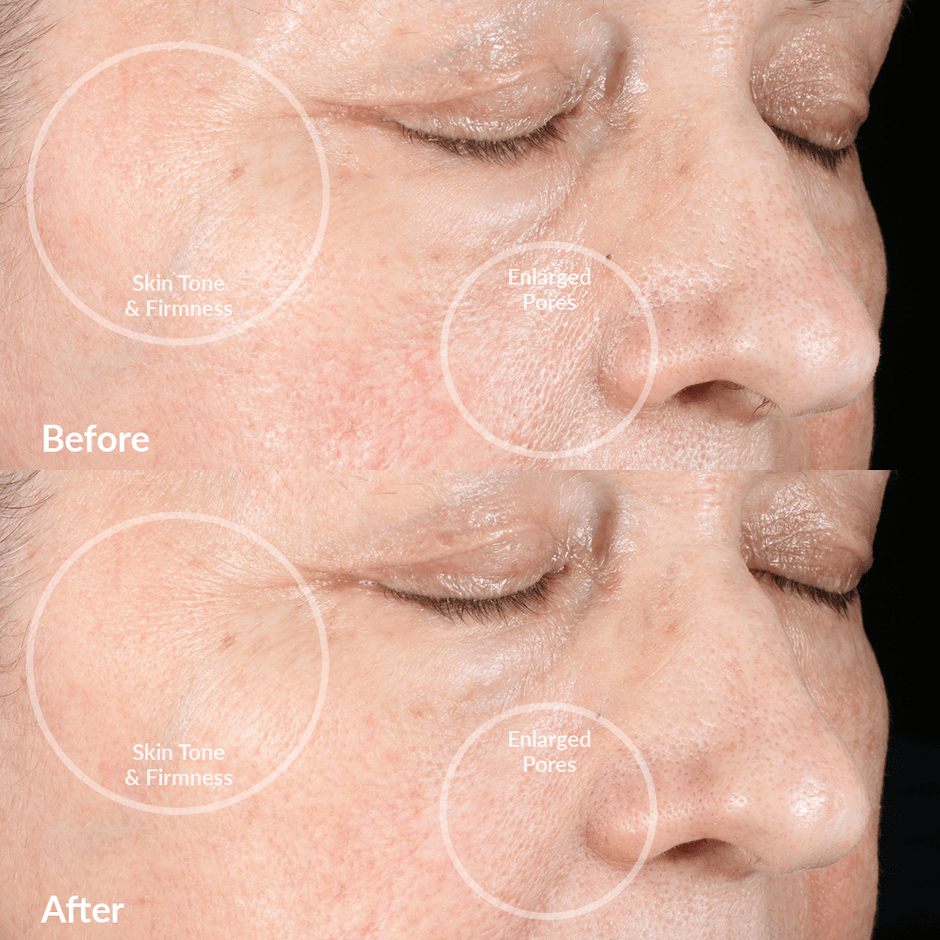 PMD Clean | Smart Facial Cleansing Device – PMD Beauty